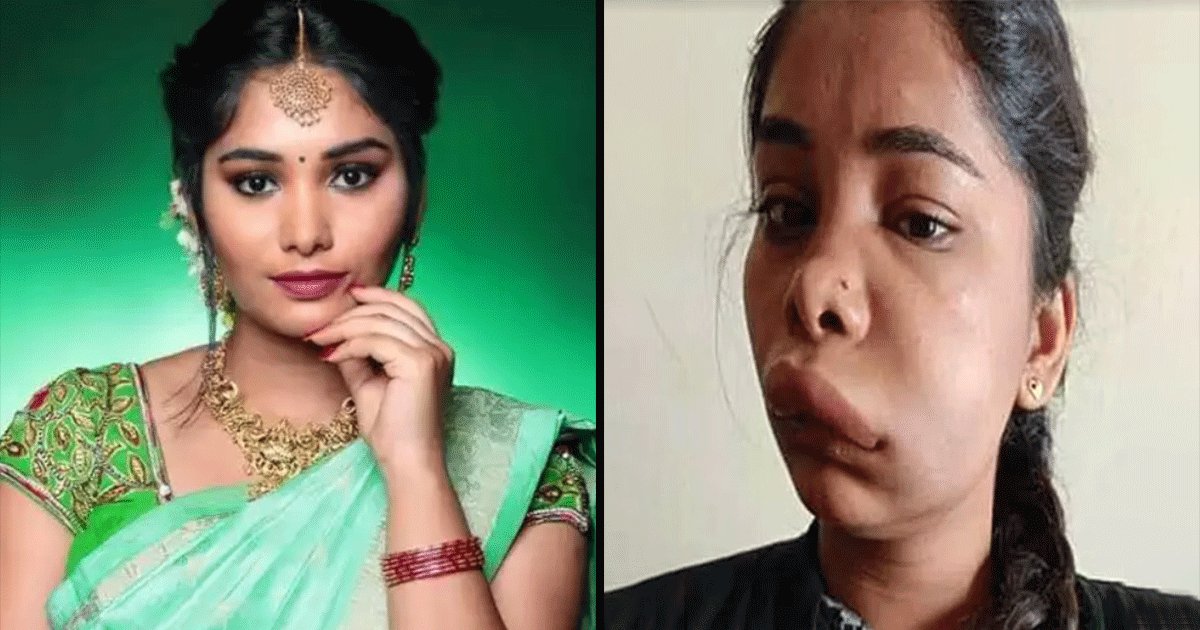 Kannada Actress Swathi Satish: जानिए रूट कैनाल सर्जरी के फ़ेल होने के 8 ...