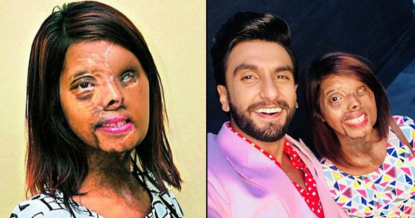 acid attack fighter Anmol Rodriguez inspirational story